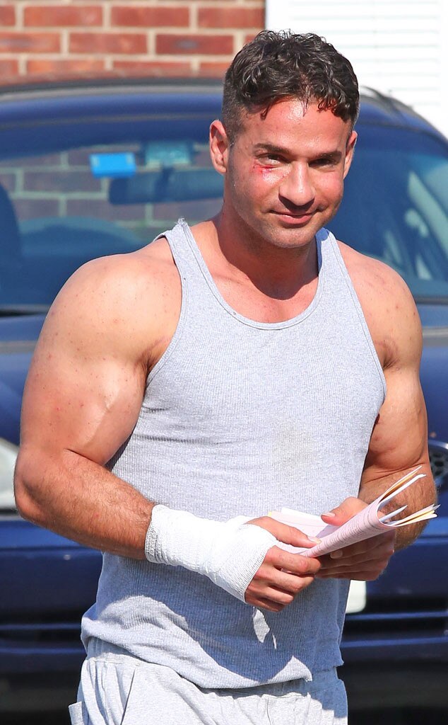 Mike The Situation Sorrentino Is All Bloody and Banged Up After Tanning ...