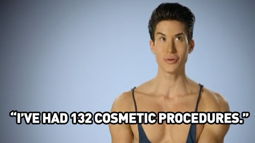 Human Ken Doll from Most Interesting Patients on Botched