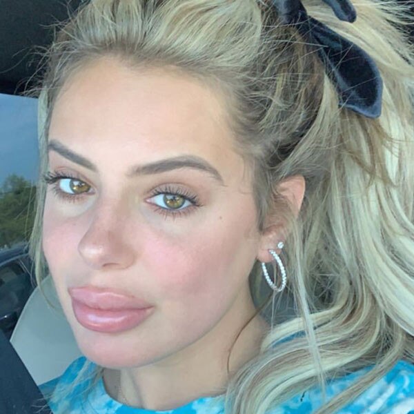 Amber Heard Details Alleged Abuse by Johnny Depp in Response to His ...